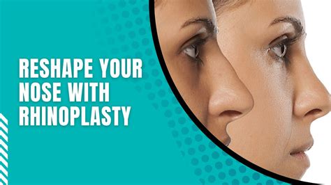 Nose Lifters” Are The Diy Hack To Reshape Your Nose Upapgu
