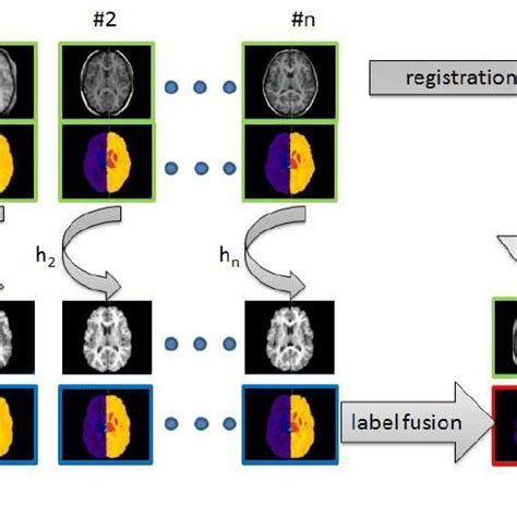 Visual Evaluation Of Brain Segmentation Results IBSR Image First Download Scientific