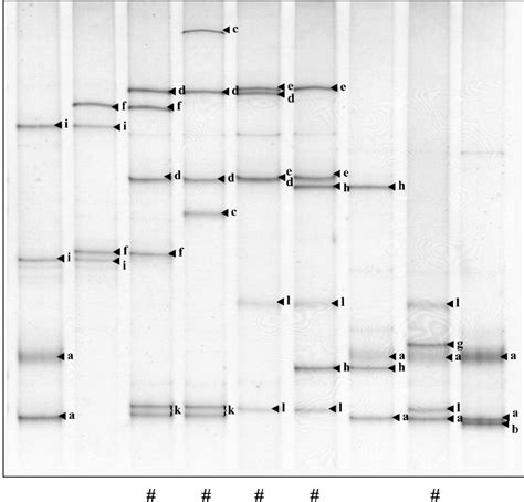 Single Strand Conformational Polymorphism Sscp Of The Caprine Dqa2