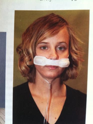 Oxygen Delivery Flashcards Quizlet