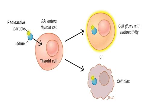 Hyperthyroidism Clinical Features And Its Management Ppt