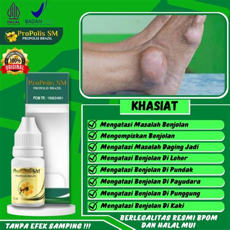 Jual Obat Benjolan Di Leher Obat Benjolan Payudara Benjolan Di Paha