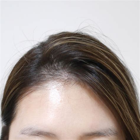 잔머리픽서 아비다선 헤어픽서 쉬운 앞머리 잔머리정리 네이버 블로그