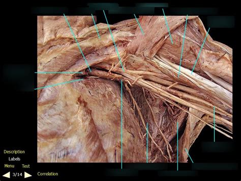 Axilla 3 Diagram Quizlet