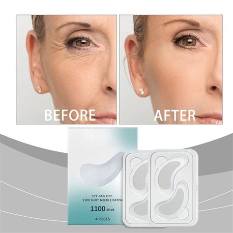 2pairs Microneedle Firming Eye Patch Anti Aging Wrinkle Fine Line