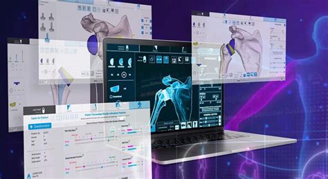 Exactech Launches Next Generation Shoulder Planning App Orthoworld