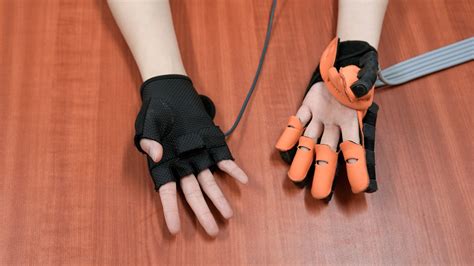 Video Author Spotlight Advancing Upper Limb Rehabilitation In Patients With Right Hemisphere