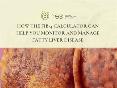 How The Fib 4 Calculator Can Help You Monitor And Manage Fatty Liver
