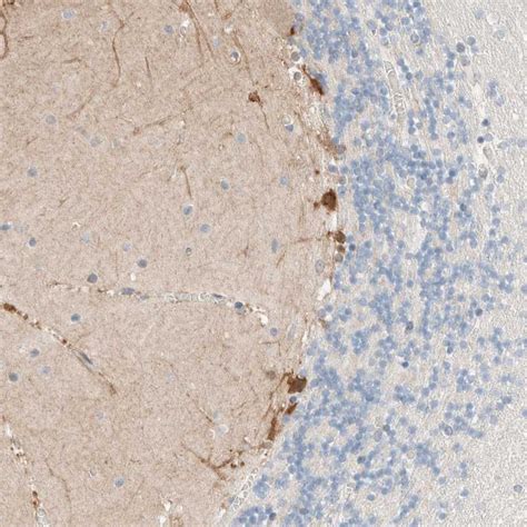 Rabbit Polyclonal Anti Pcm1 Antibody Buy For Research Highly