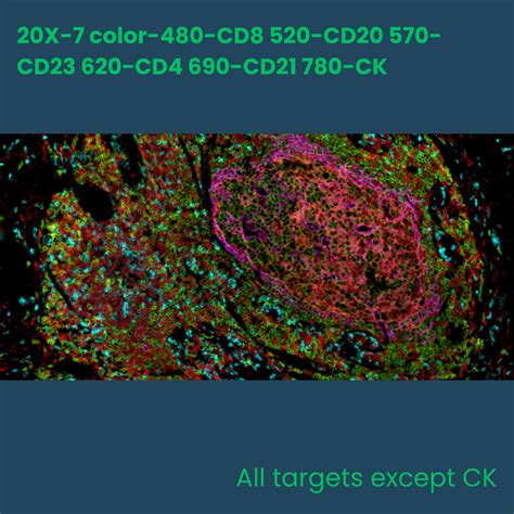 7 Color Multiplex Fluorescence Ihc Detection Kit Rabbit On Rodent