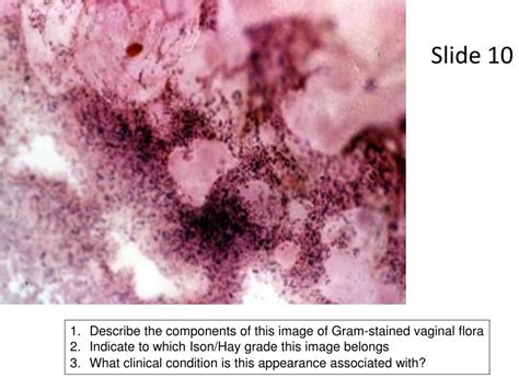 Ppt Test Your Ability To Read Gram Stained Genital Samples Powerpoint