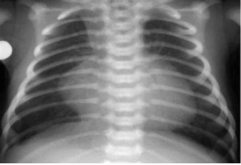 Pediatric Cardiology Part 1