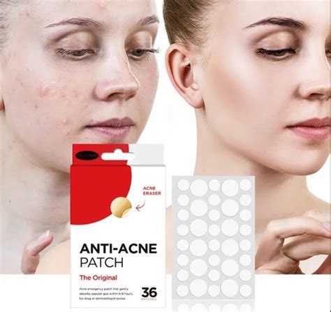Wholesale Price Mighty Hydrocolloid Anti Acne Spot Acne Pimple Patches From Cosmetics At ₹ 699