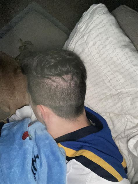 First Pic Is When I First Noticed My Cvg About 2 Years Ago And The Rest Were Taken Earlier This