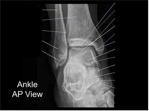 Ankle Ap View Diagram Quizlet