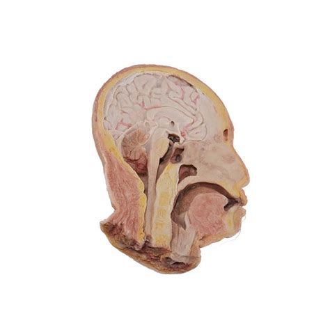 China Trigeminal Nerve Anatomy Model Manufacturers Suppliers Factory Meiwo
