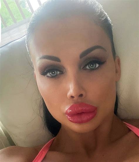 Pin By Jonna On Lips Filler Blonde Hair Girl Botox Lips Girls Lips