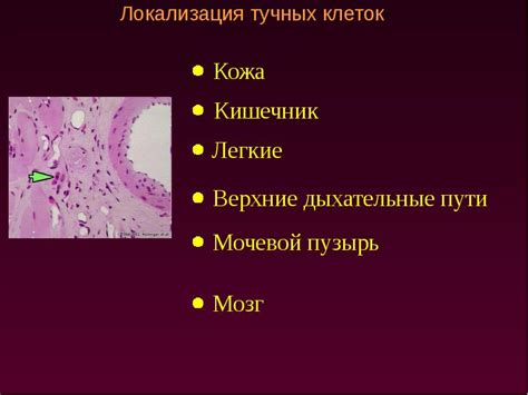 Тучные клетки - презентация, доклад, проект скачать
