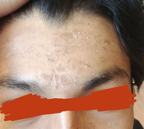 123 Best R Esthetics Images On Pholder Reality Of Working In A Chain Salon