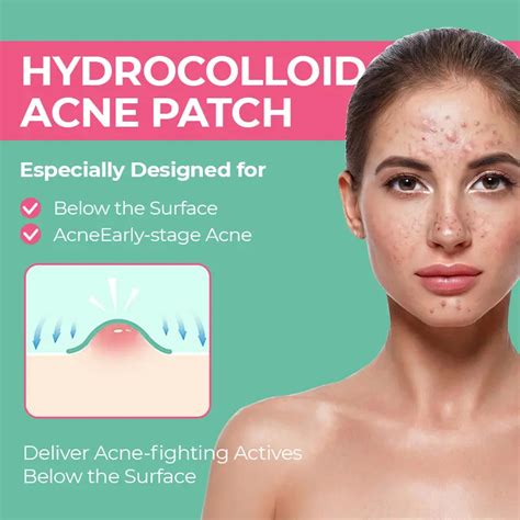 Custom Acne Patches Private Label Pimple Solutions