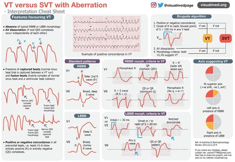 Vt Vs Svt With Abberation Infographic Visualmed