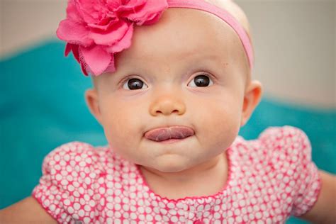 Короткая уздечка языка у ребенка симптомы у новорожденного как их определить Как растянуть