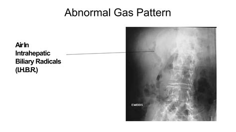 X Rays In Surgery For Undergraduates Dr Dev Taneja 06062021 Lung And Respiratory Health X Rays In Surgery For Undergraduates Dr Dev Taneja 06062021 Lung And Respiratory Health