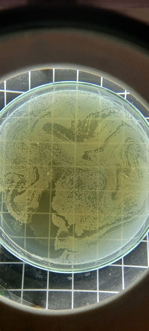 Moaz Rasool On Linkedin Microbiology Qc Qa