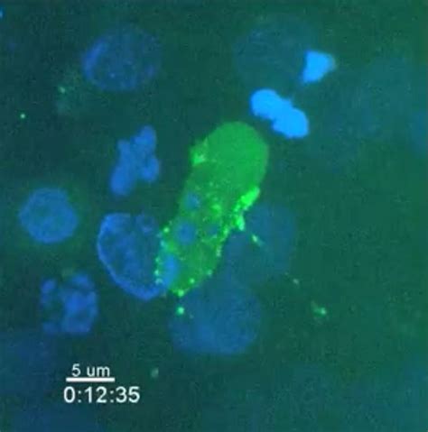 Video Reveals How Hiv Infects Healthy Cells During Sex And How To