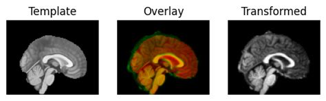 Registration With Dipy — Practice And Theory Of Brain Imaging