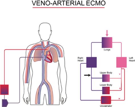 Ecmo Specialist Flashcards Quizlet