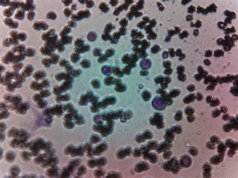 Malaria Detection Using Open Microscope And Deep Learning