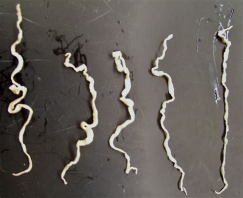Taeniasis Saginata Infection Morphology And Lifecycle Clinical Features Diagnosis Treatment