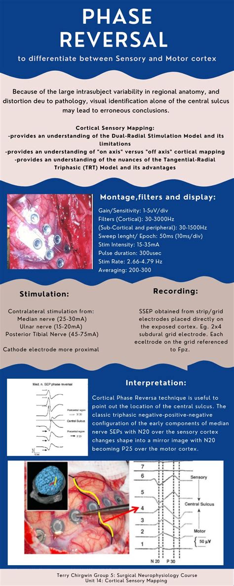 Rebecca Rendahl Bscnim Reeg Tfaset On Linkedin Sensorymapping Phasereversal