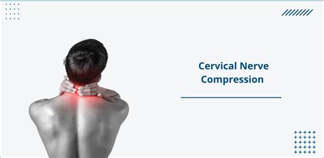 Causes And Symptoms Of Cervical Nerve Compression
