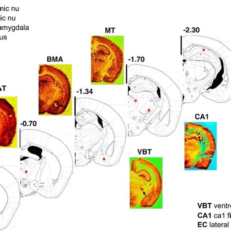 quantification of slow spike wave discharge sswd duration in s h as