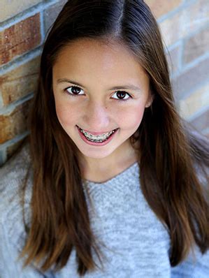 Metal Braces Baum Orthodontics Los Angeles Ca
