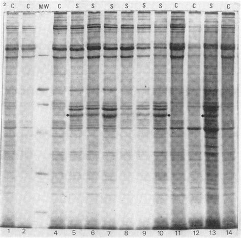 Figure 2 From Polypeptide Synthesis In Columnar And Squamous Explants
