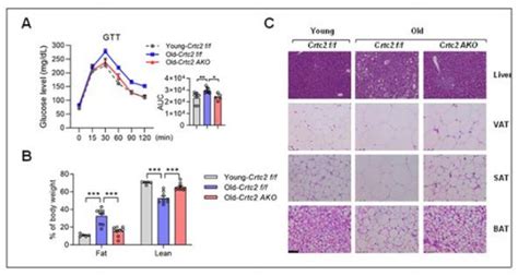 Unveiling A New Mechanism That Accelerates Aging Of Adipose Tissues