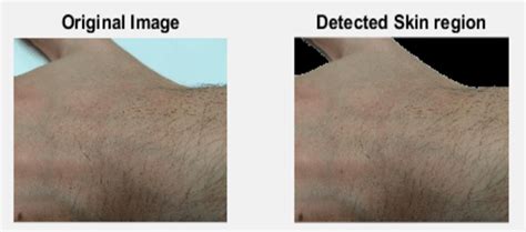 The Output Of Our Proposed Skin Detection Scheme Image A Shows The Download Scientific
