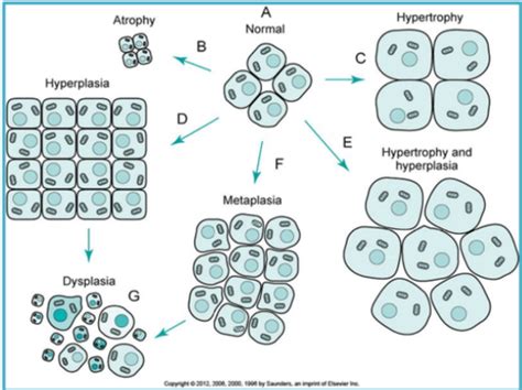 Gen Path Introduction To Cell Pathology Flashcards Quizlet