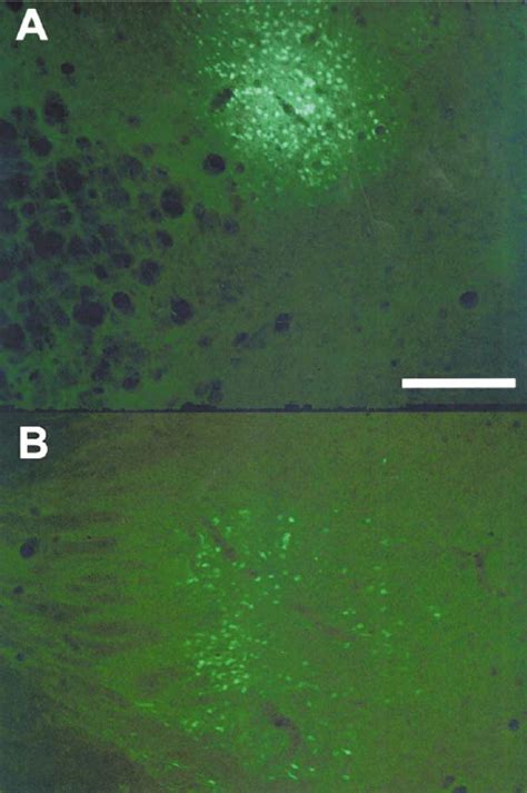 Native Gfp Expression In The Cd Mouse Thalamus A Thalamic Gfp Download Scientific Diagram