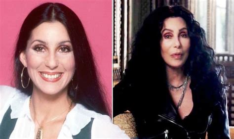 Cher Plastic Surgery Then And Now What Has The 75 Year Old Star Had Done Uk