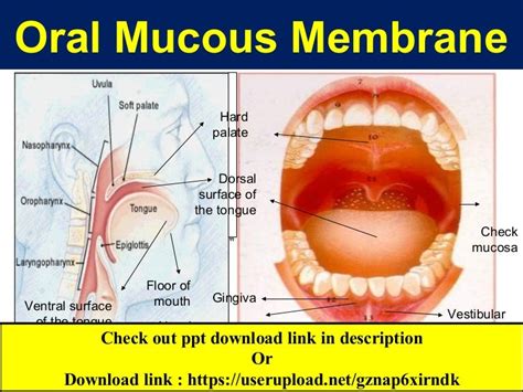 Mucus Seal On Gum Mucous Cyst Types Causes And Treatment Ehtn