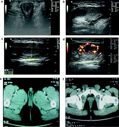 References In Does MRI Add To Ultrasound In The Assessment Of Disorders Of Sex Development