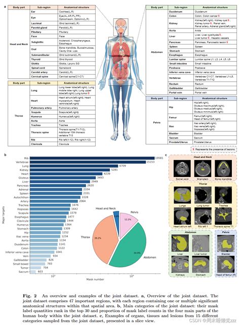 3d医学图像分割大模型 segvol universal and interactive volumetric medical image
