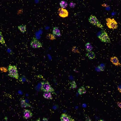 Multiplex Fluorescence In Situ Hybridization Using Rnascope On Paraffin Embedded Human Nervous