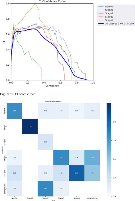 Figure 10 From Yolo Based Deep Learning Model For Pressure Ulcer Detection And Classification