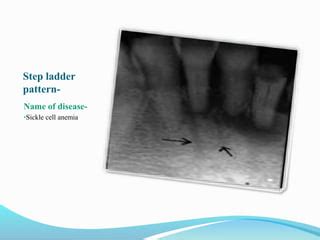 Typical Radiological Feature Pptx