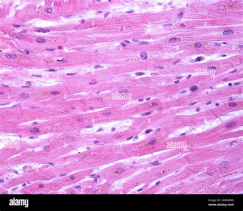 Light Micrograph Of Striated Muscle Fibres Of The Heart Myocardium Stained With H E The Cardiac